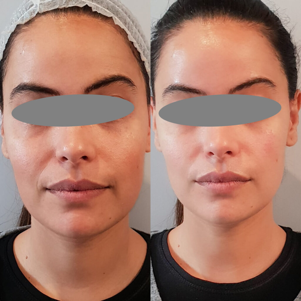 Beauty & Medical Aesthetic Supplier | Promoitalia Products